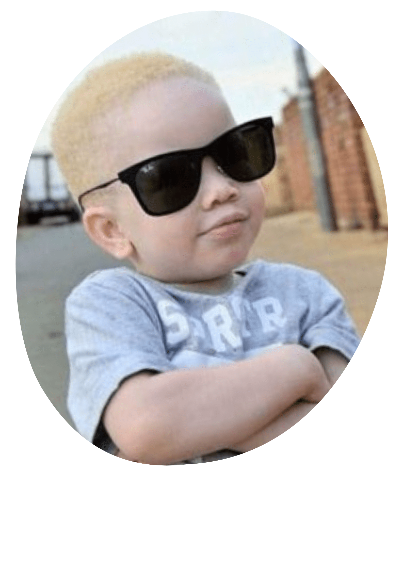 Sunglasses – Albinism Foundation of Zambia – AFZ